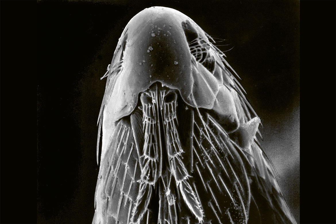 La mutation qui a rendu la peste si dangereuse